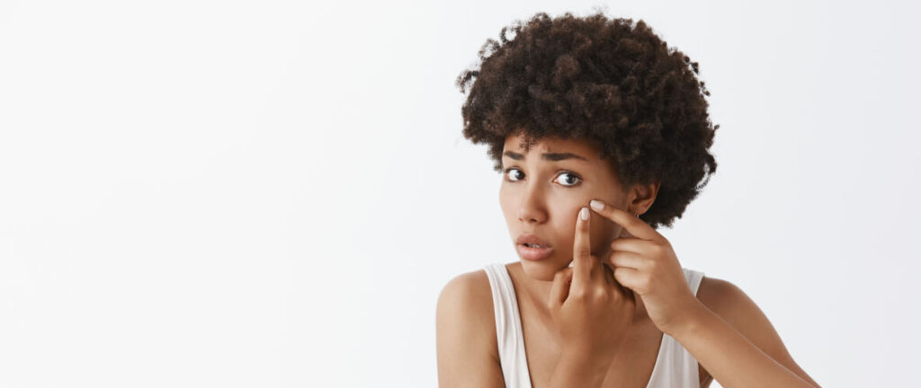 ¿Qué significa comedogénico en cosmética?